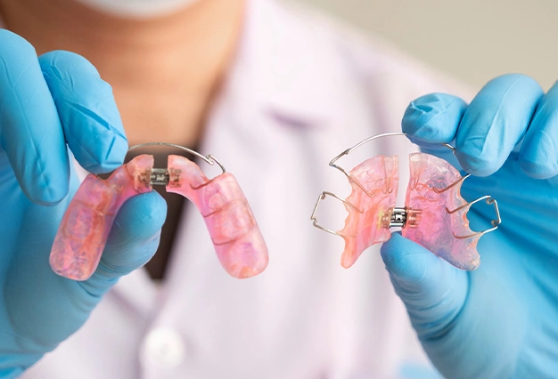 Retainers Long Beach CA - Long Beach Dental Health