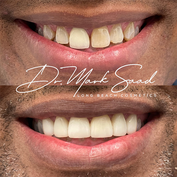 Smile Gallery - Long Beach Dental Health