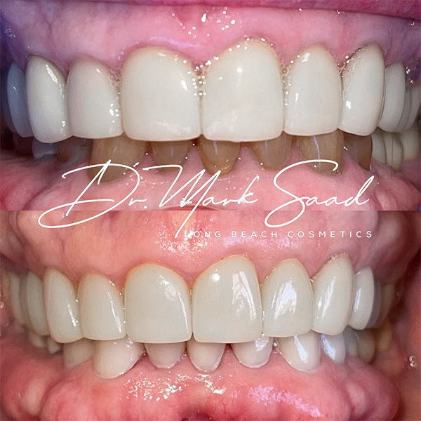 Smile Gallery - Long Beach Dental Health